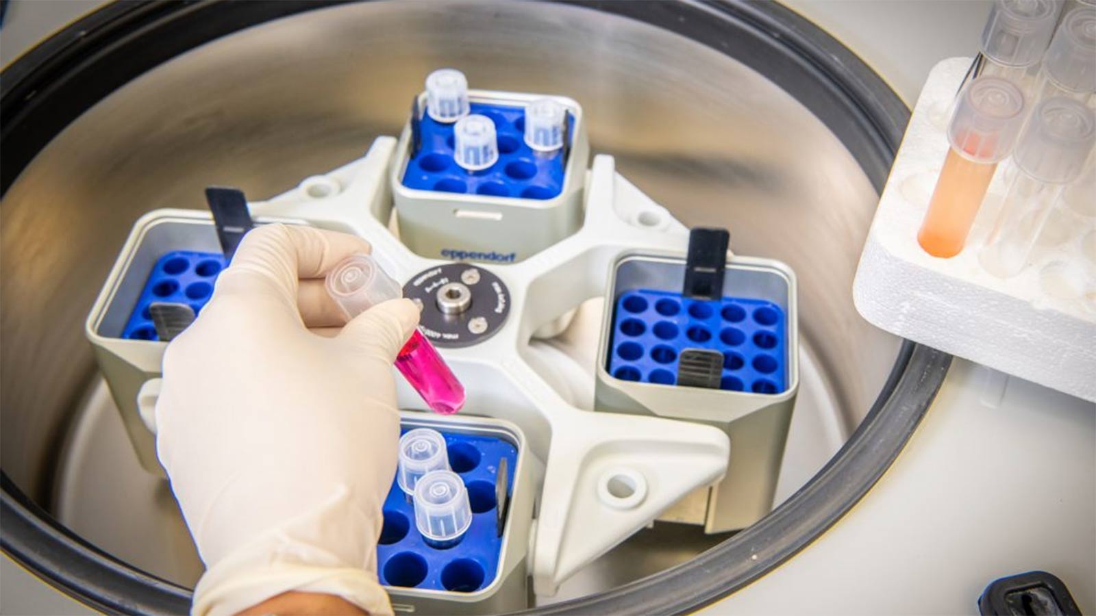 Vertex Nears Historic Breakthrough: Stem Cell Therapy Poised to ...