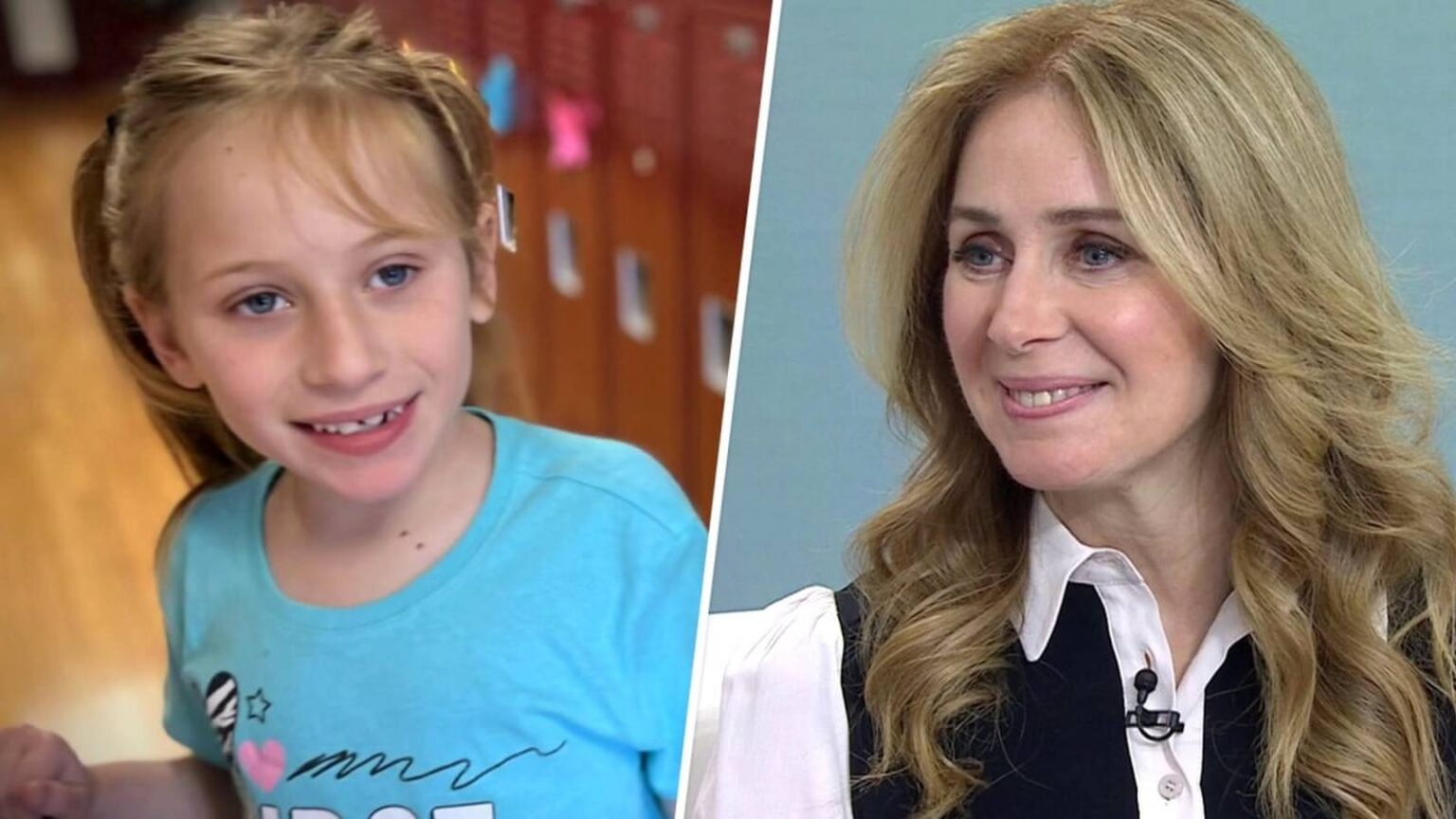 Բեքի Քվիքի դուստրը՝ Քեյլին. լույս սփռելով SynGAP1-ի և հազվագյյուտ ...